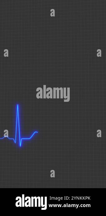 ECG, electrocardiogram of a healthy person, normal heart rhythm. Looped ...