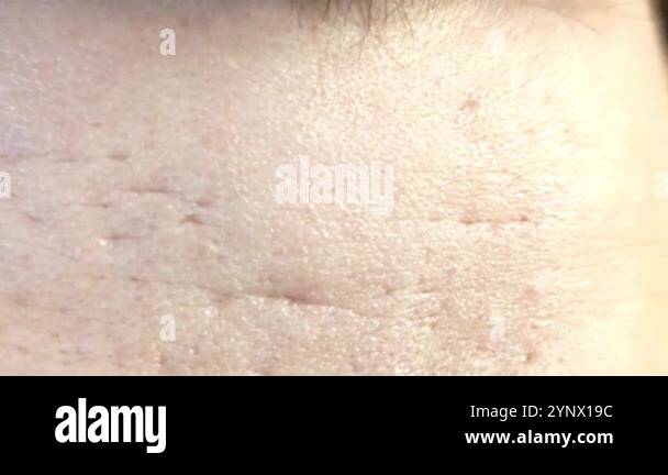 Skin texture is shown in detail featuring subtle lines and slight ...