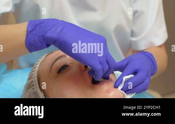 Doctor cosmetologist removes anesthesia and analgesic cream, prepares ...