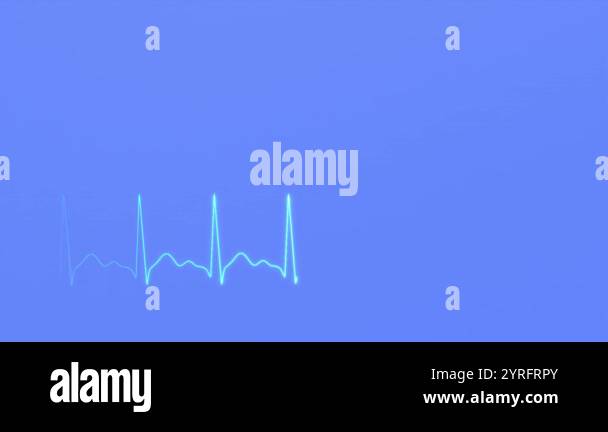 Increased heart rate Stock Videos & Footage - HD and 4K Video Clips - Alamy