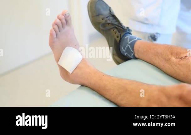 Nurse in clinic carefully removing patch from patients leg following ...