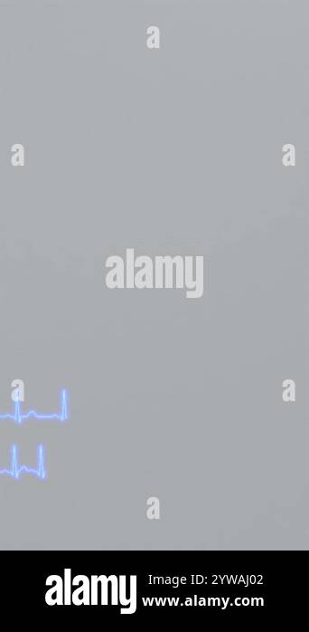 ECG graphs comparison of normal heart rhythm and arrhythmia Stock Video ...