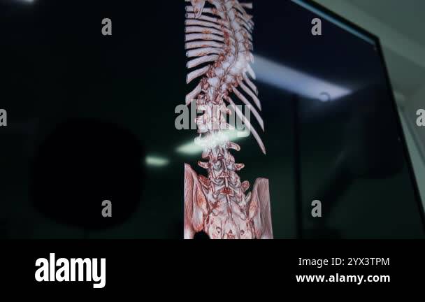 Curved skeleton Stock Videos & Footage - HD and 4K Video Clips - Alamy