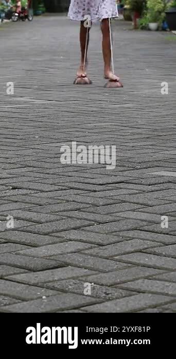 A young girl creatively uses a coconut shell as a stilt, showcasing ...