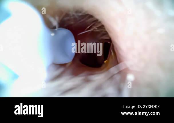 Otoscope view Stock Videos & Footage - HD and 4K Video Clips - Alamy