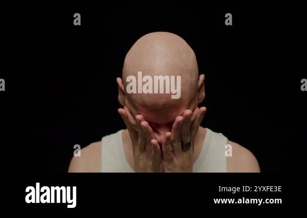 Dramatic closeup portrait of person with alopecia in white undershirt ...