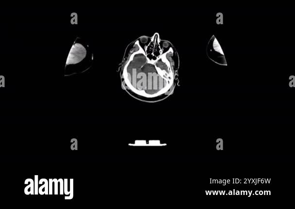 Detailed cross section reveals human brain anatomy, cranial features ...