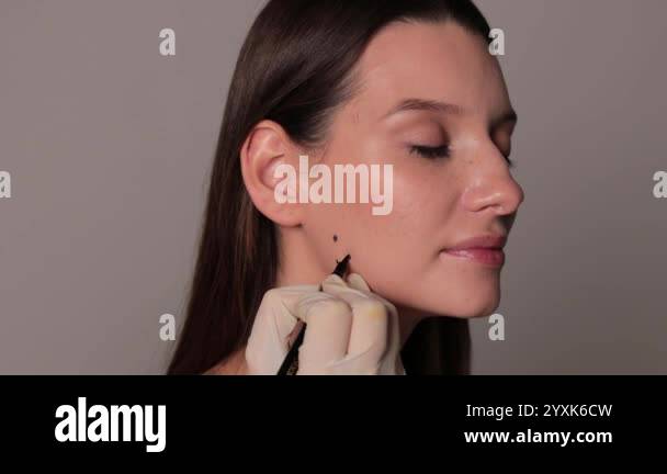 Bruxism markup for teeth grinding by a cosmetologist 4k video. Bruxism ...