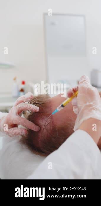 Alopecia. Man hair loss treatment regeneration. Trichologist ...