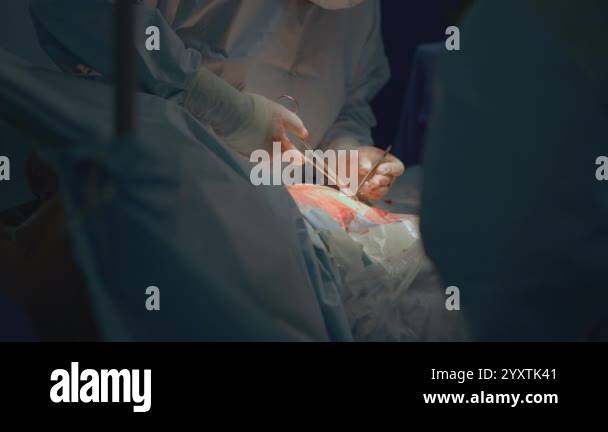 A surgeon carefully stitches the incision on a womans belly during the ...