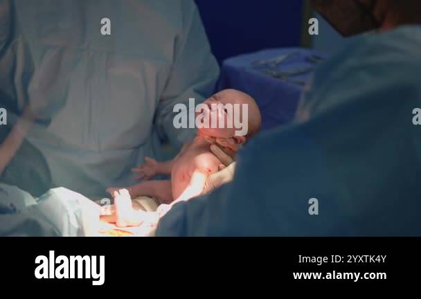 A newborn baby is carefully lifted from the mothers belly during a ...