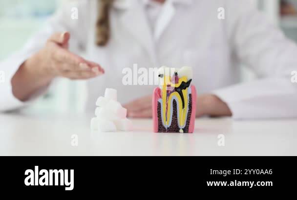 Woman dentist shows impact of sugar on dental health. Doctor uses model ...