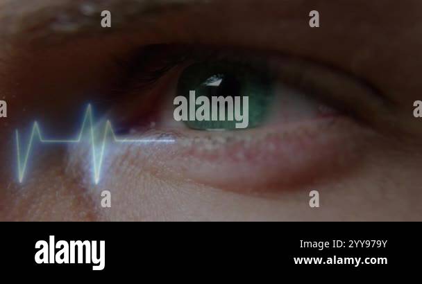 Visual sensitivity Stock Videos & Footage - HD and 4K Video Clips - Alamy