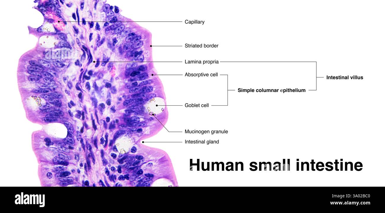 This is a histological photograph of the human small intestine, which ...