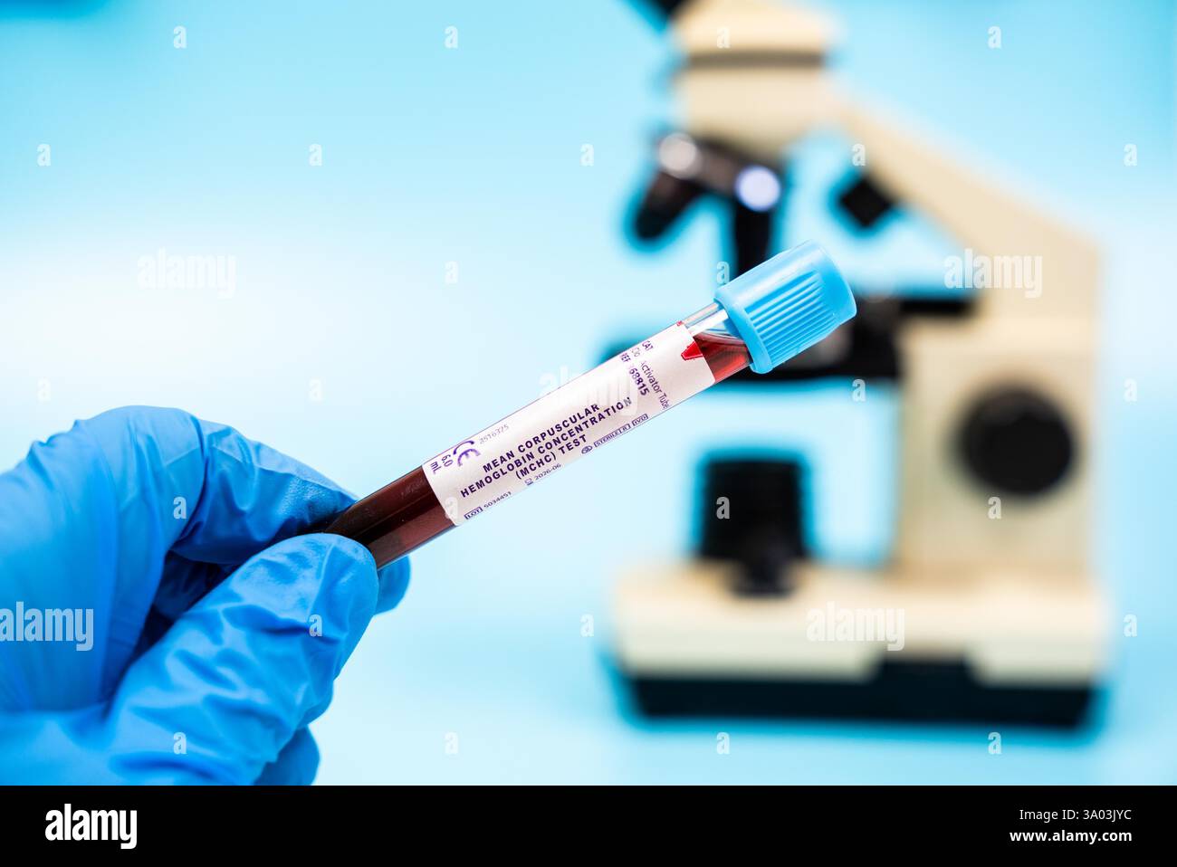 Measures the concentration of hemoglobin in red blood cells, important ...