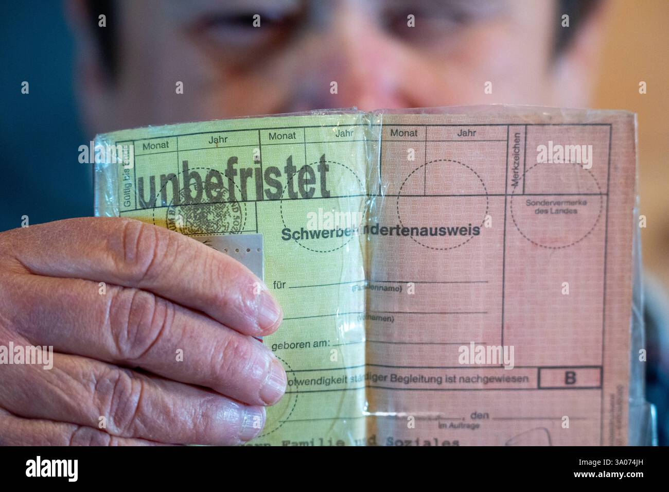 Bavaria, Germany - 2 March 2025: A person holds a severely disabled ...