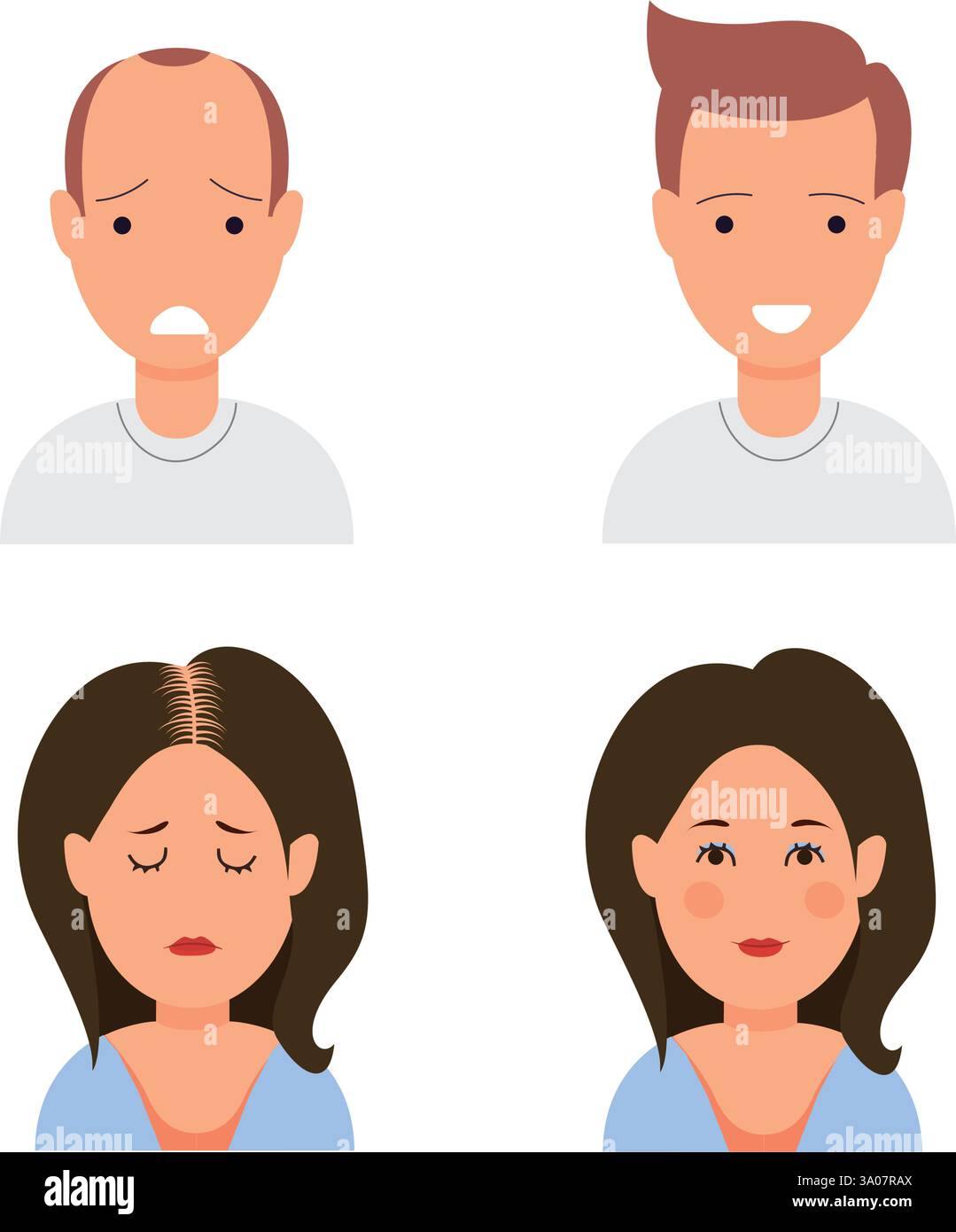Human hair transplant. Woman and man before and after transplantation ...