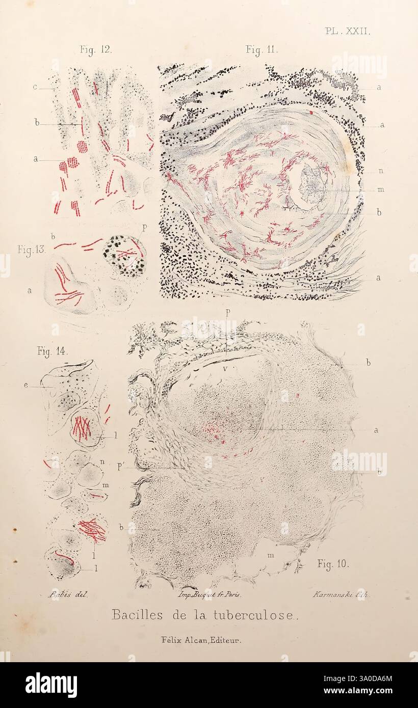 Bacillus within lung tissue hi-res stock photography and images - Alamy