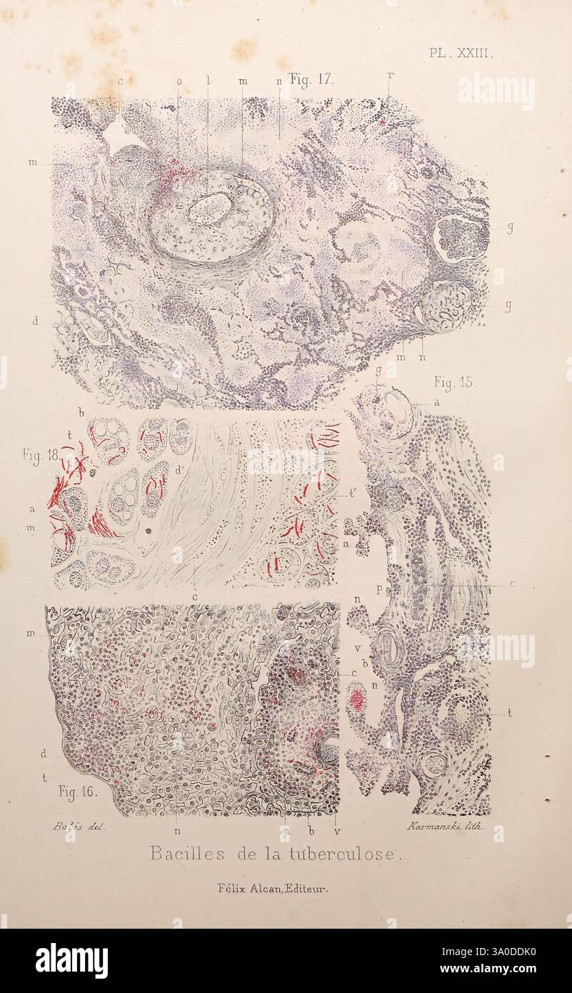 Detailed scientific examination of tuberculosis bacteria hi-res stock ...