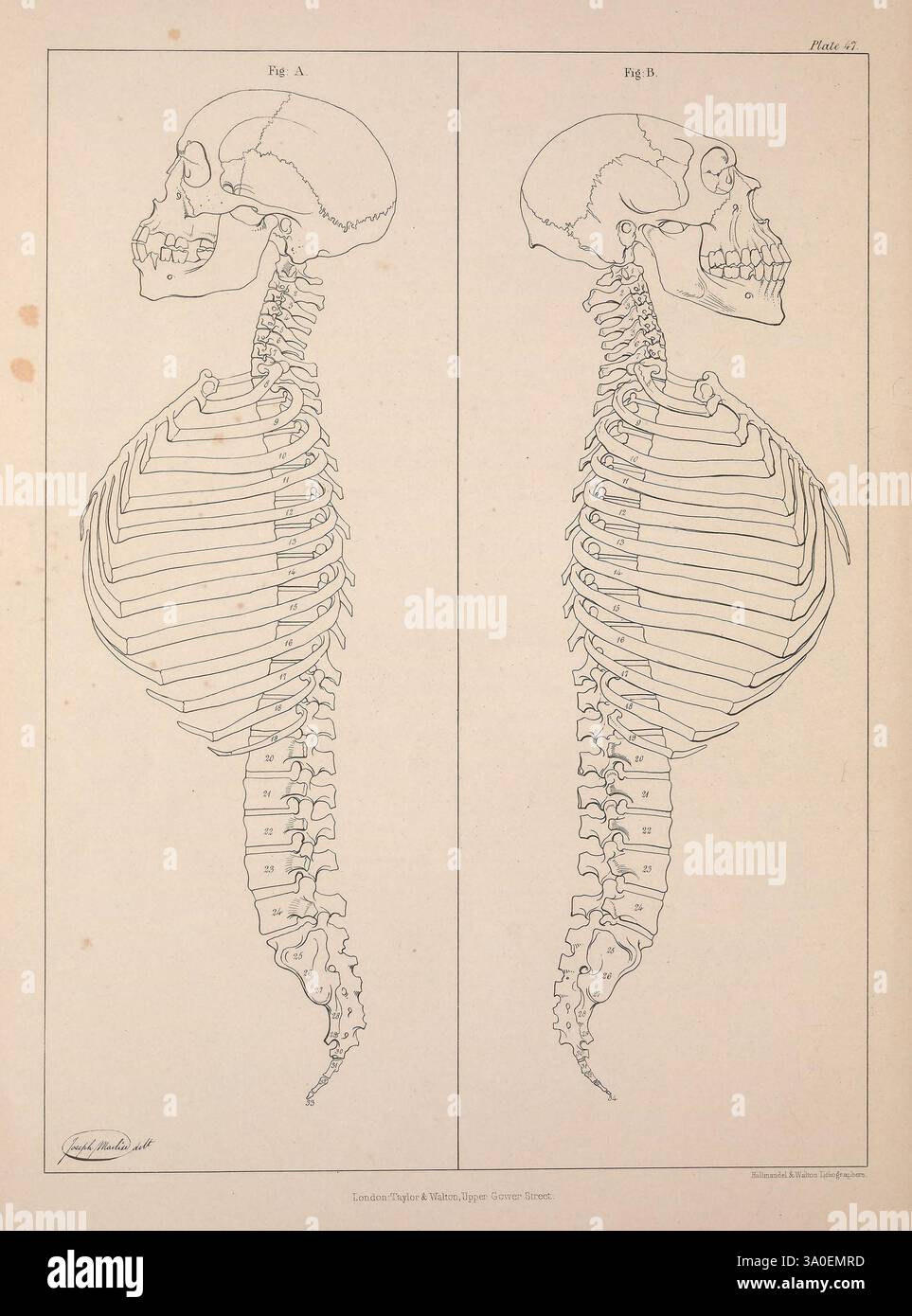 Side anatomical diagrams hi-res stock photography and images - Alamy