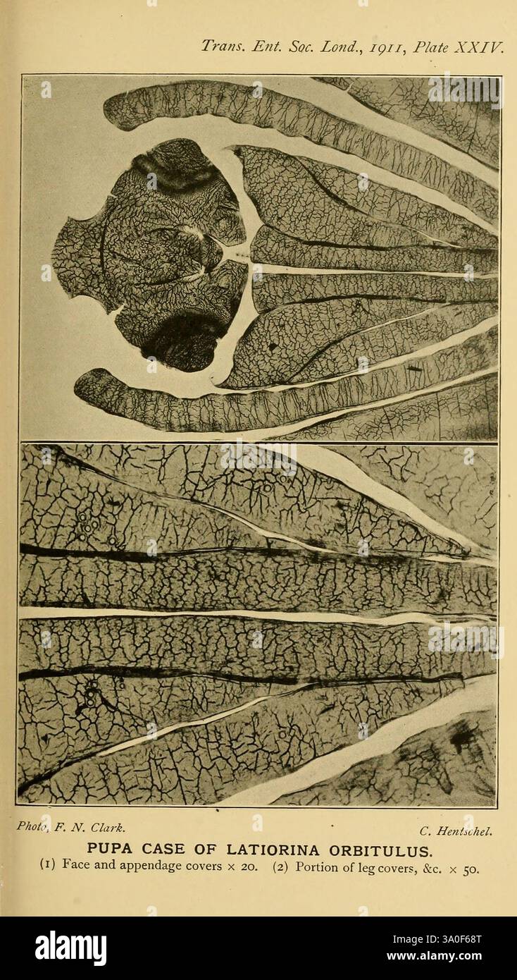 Pupas anatomy hi-res stock photography and images - Alamy
