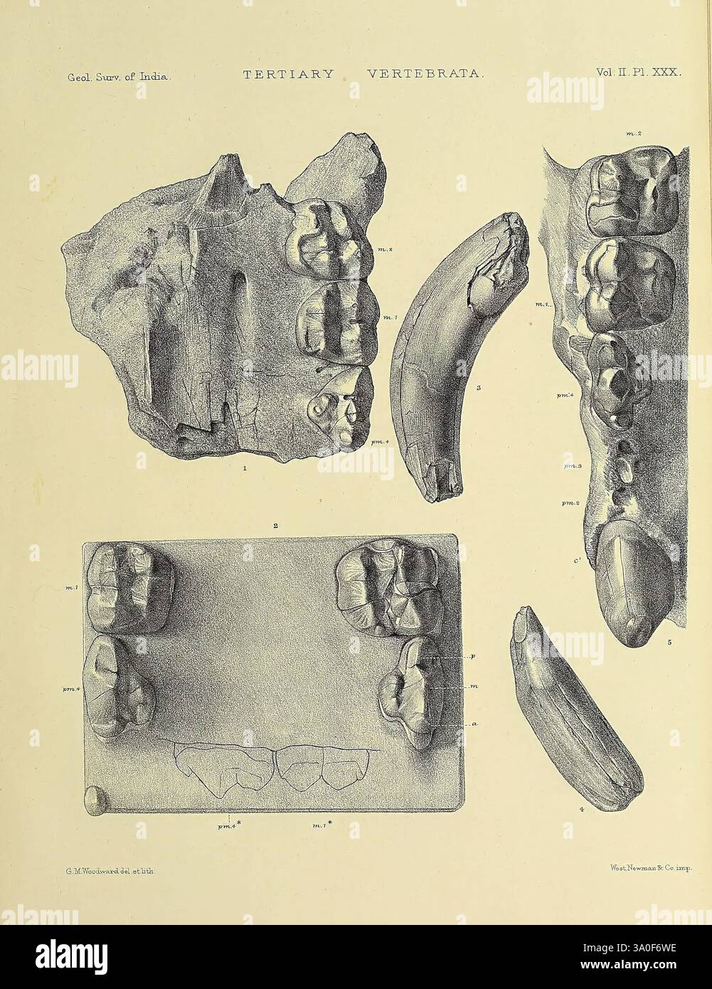 Additional molar teeth hi-res stock photography and images - Alamy