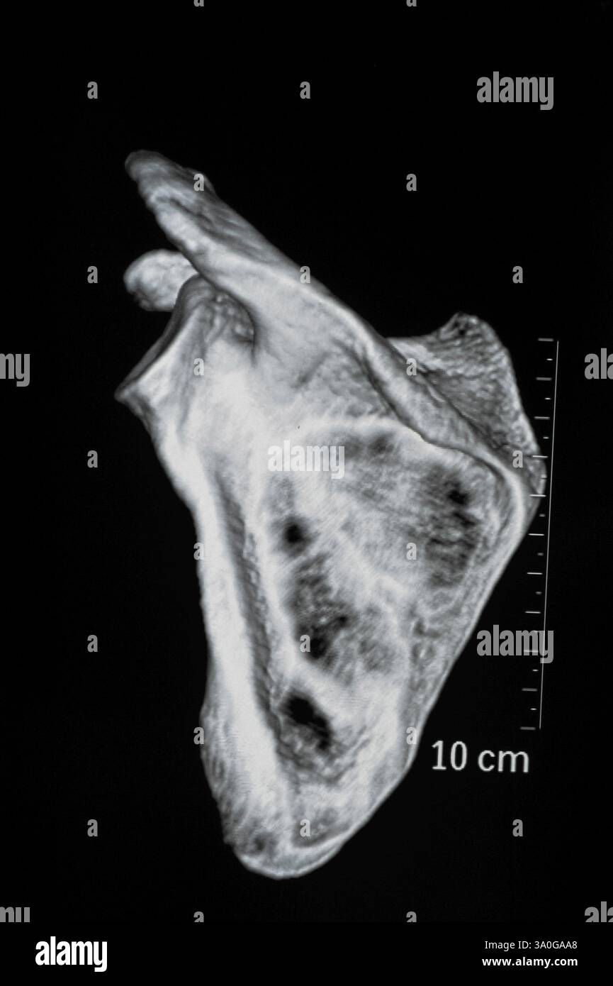 Human bone CT images Stock Photo - Alamy