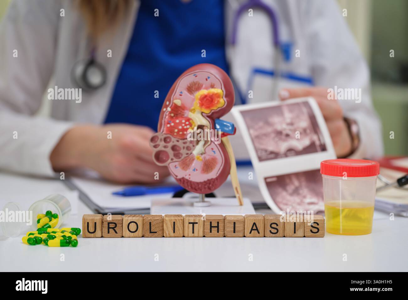 A Comprehensive Exploration of Urolithiasis Kidney Stones and Their ...