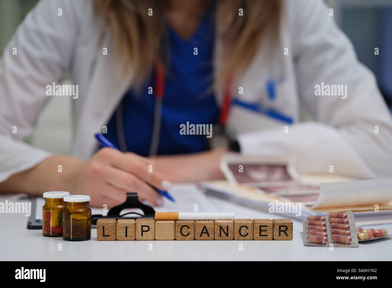 Comprehensive Medical Research on Lip Cancer Awareness, Diagnosis, and ...