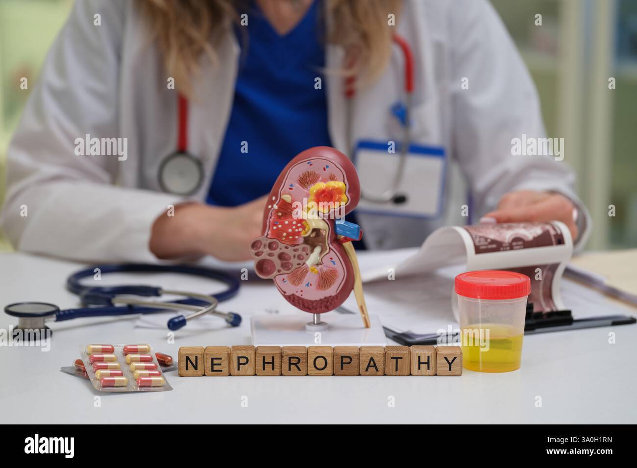 Understanding Nephropathy Valuable Insights into Kidney Health and ...