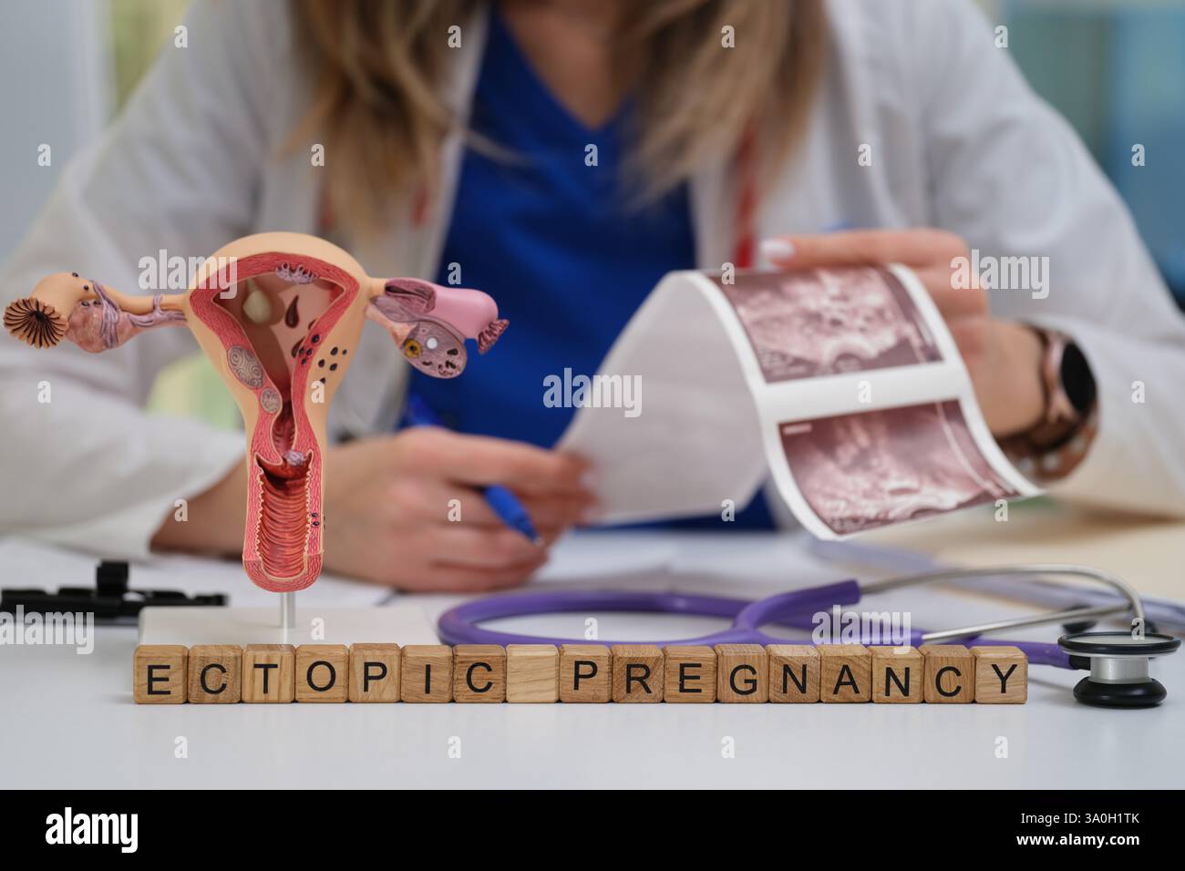 Ectopic Pregnancy Comprehensive Medical Insights, Risks Overview, and Necessary Care Guidelines ...
