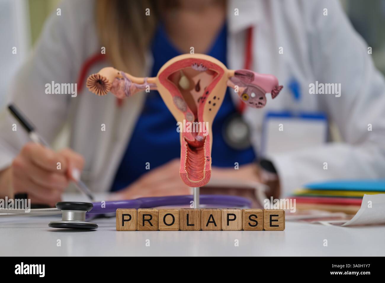 Uterine prolapse hi-res stock photography and images - Alamy