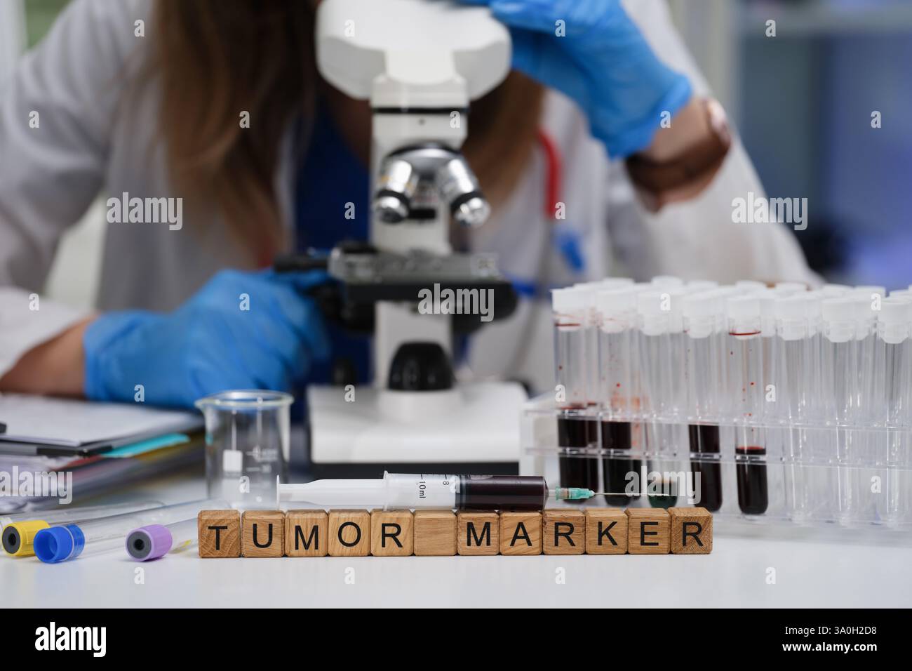 Detailed Laboratory Analysis of Tumor Markers Observed Under Microscope ...