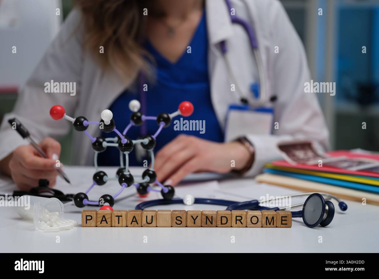 Research on Patau Syndrome Enhancing Our Understanding of Its Complex ...