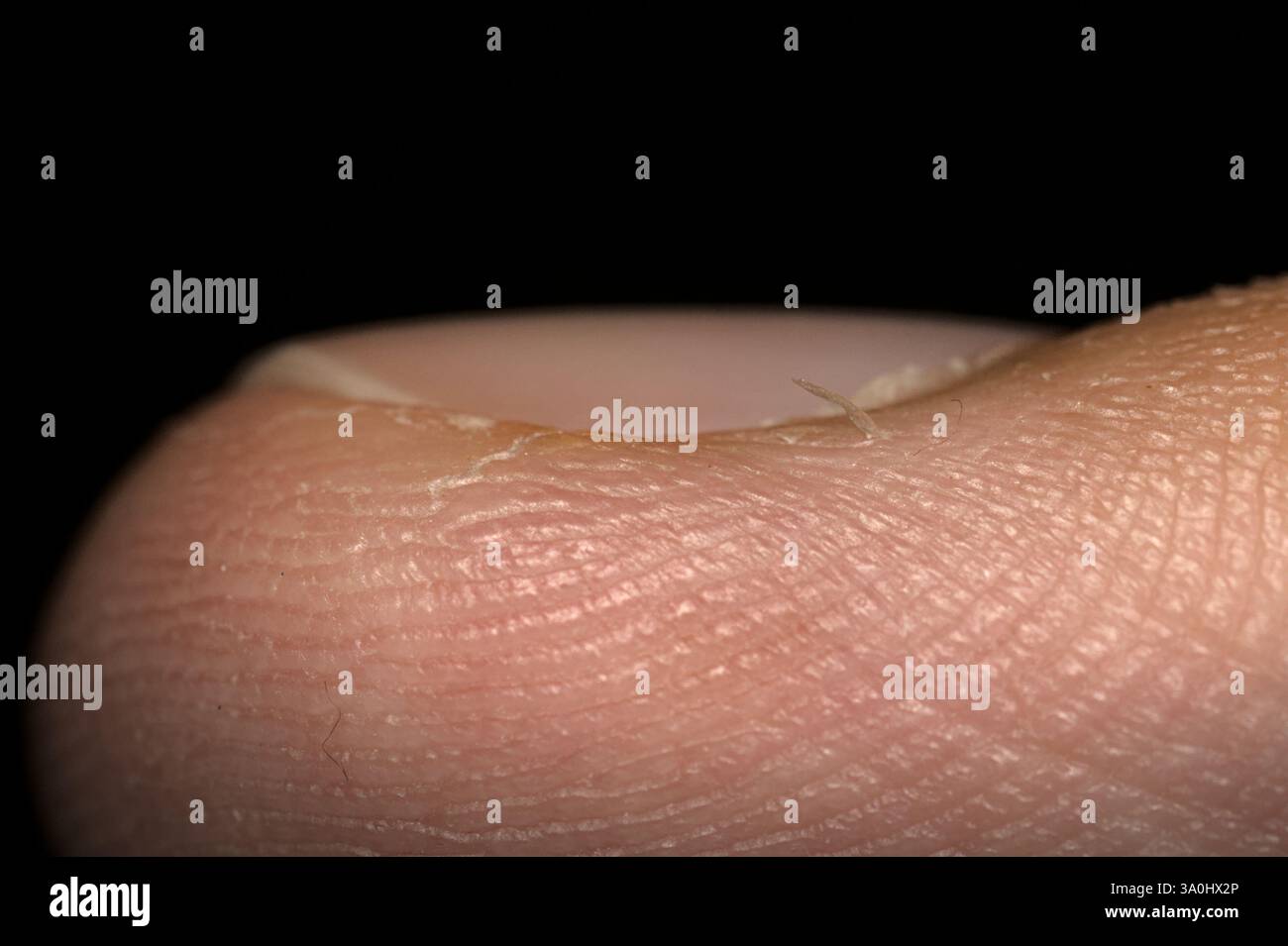 Hangnail hi-res stock photography and images - Alamy