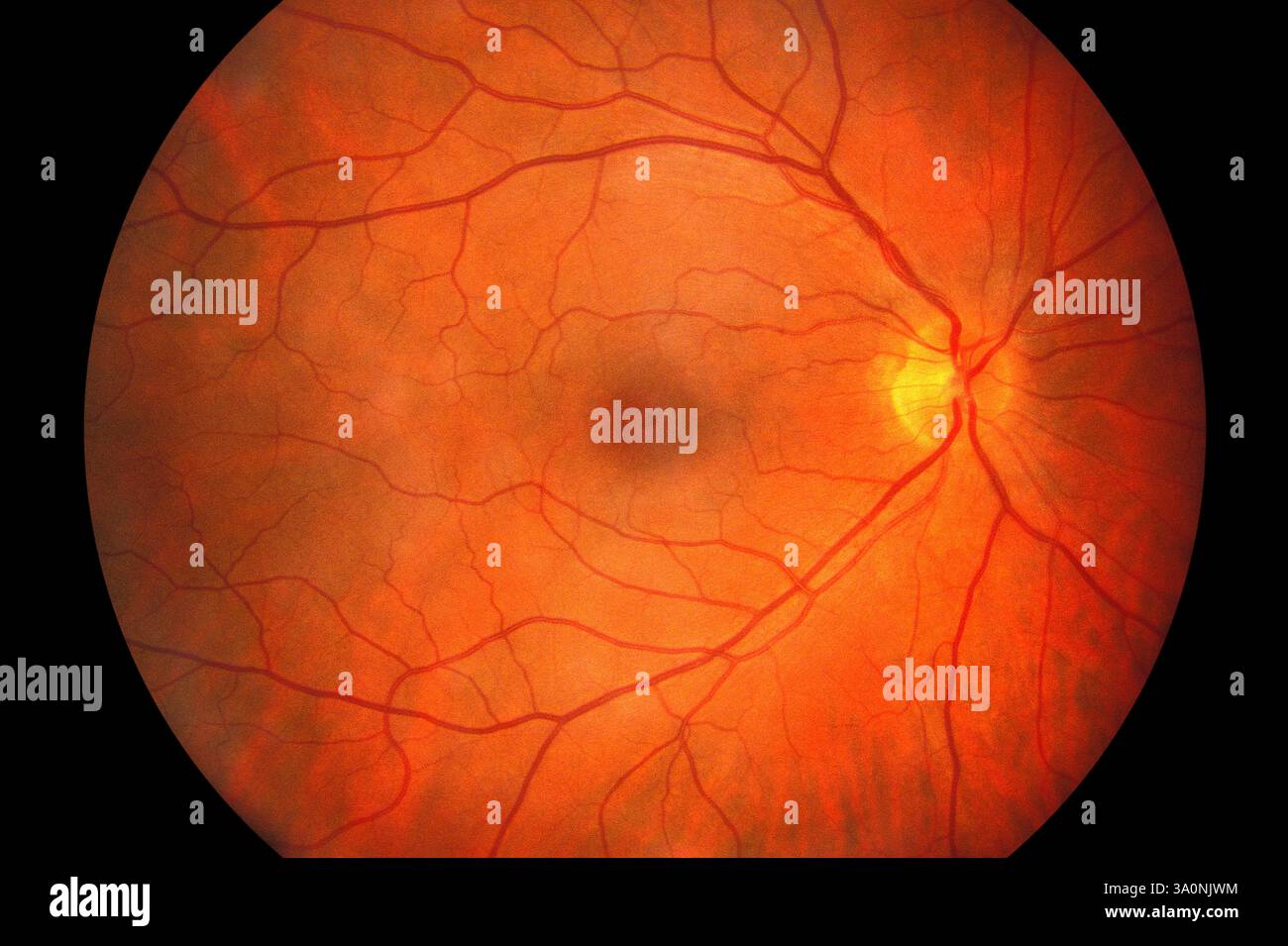 Healthy eye, fundus image. View of the interior surface of a healthy ...