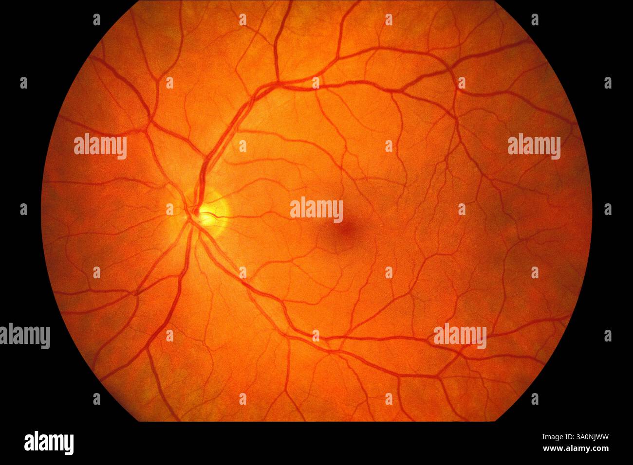 Healthy eye, fundus image. View of the interior surface of a healthy ...