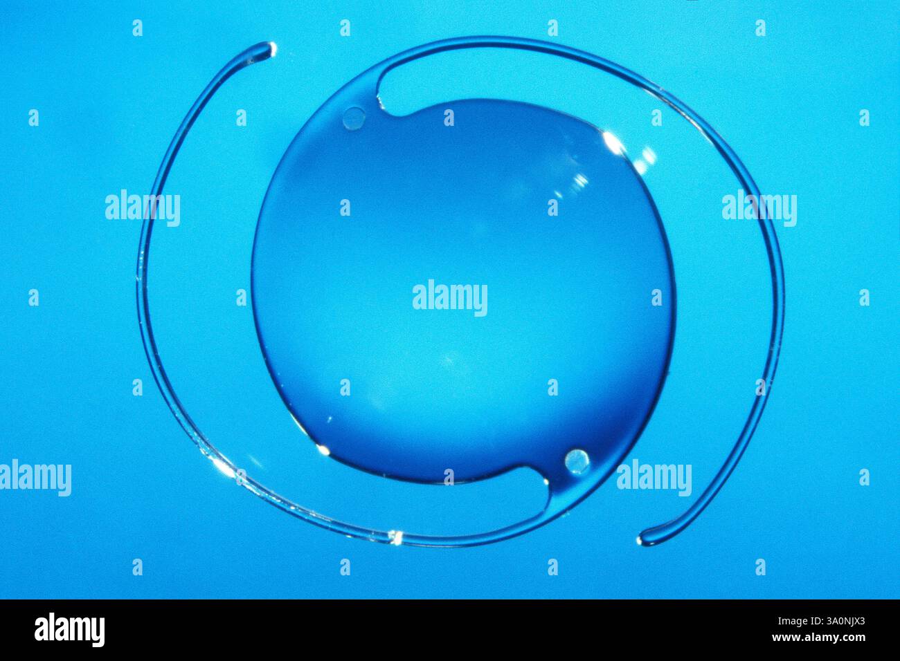 Artificial eye lens. Intraocular lens (IOL) implant used to replace the ...