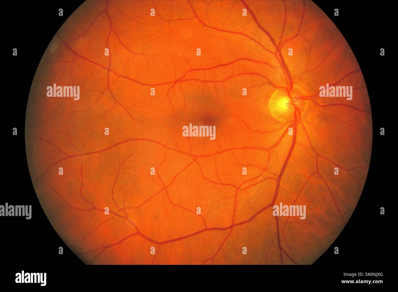 Healthy eye, fundus image. View of the interior surface of a healthy ...