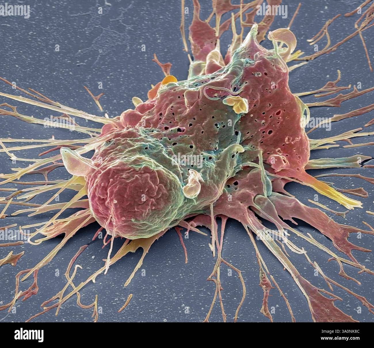 Chemotherapy induced cell death, SEM Stock Photo - Alamy