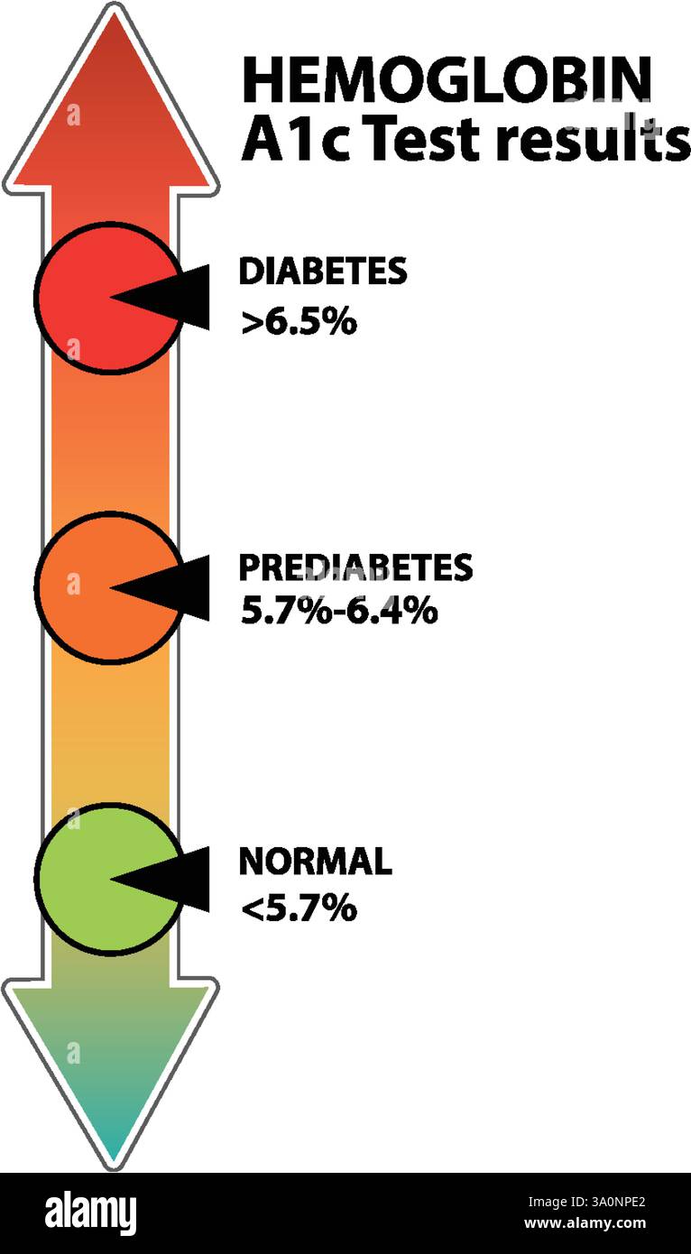 Illustration of diabetes and prediabetes test results Stock Vector ...