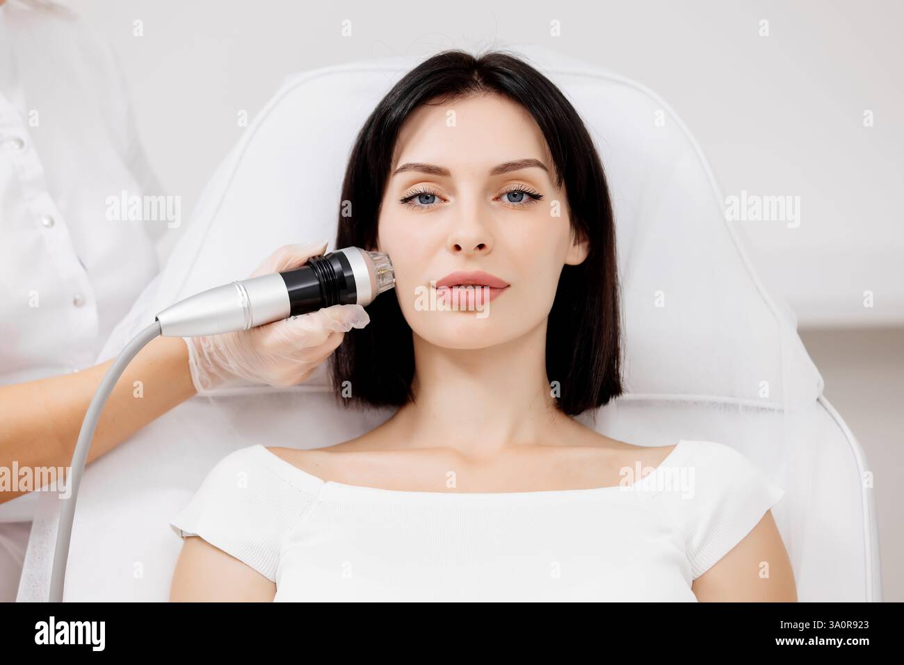 A young woman undergoes a fractional radiofrequency needle procedure ...