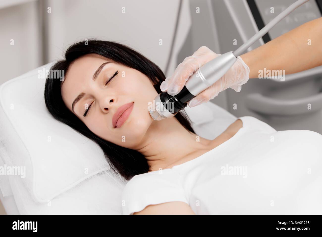 Procedure needle fractional rf face hi-res stock photography and images ...