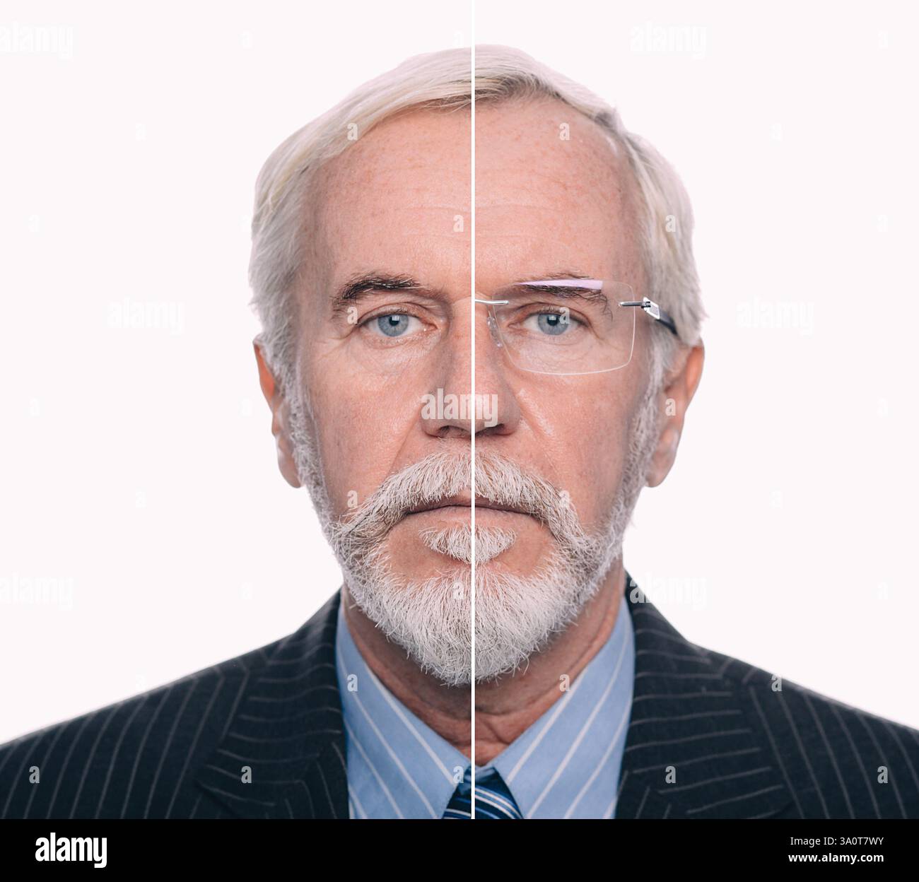 Patient undergoing an ophthalmology evaluation with noticeable eye ...