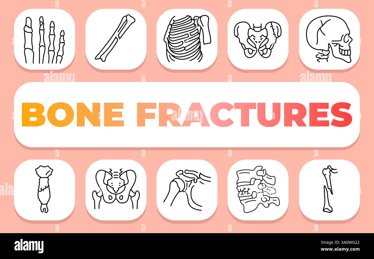 Bone Fractures Text Concept Shablon For Presentation And Infographics Minimal Clean Icons For