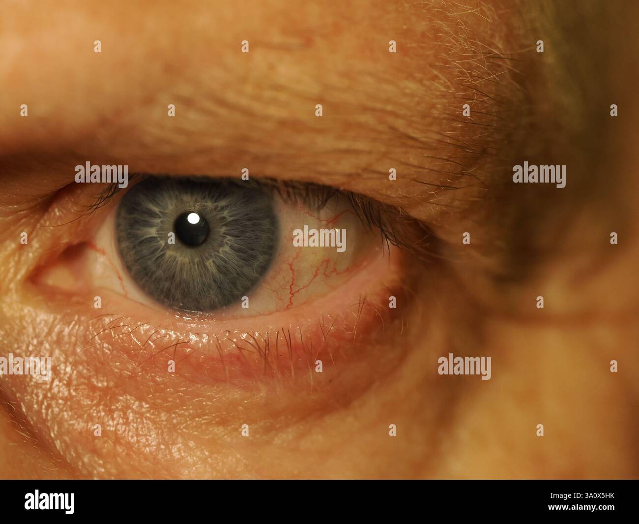 Close-up of a blue human eye sharing the bloodshot veins and the ...
