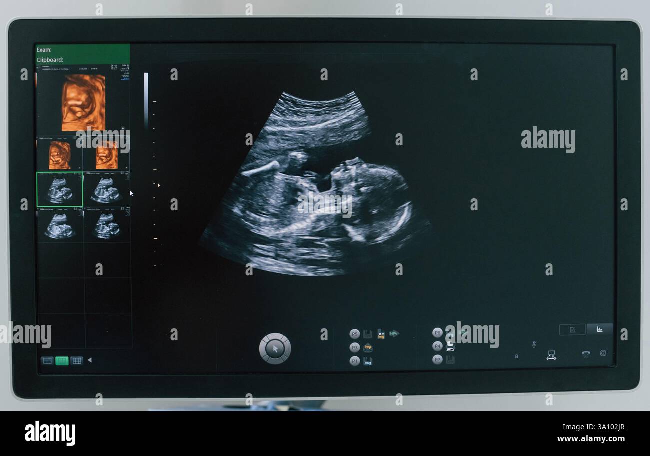 Pregnant baby infant ultrasound display. Conception of health care ...