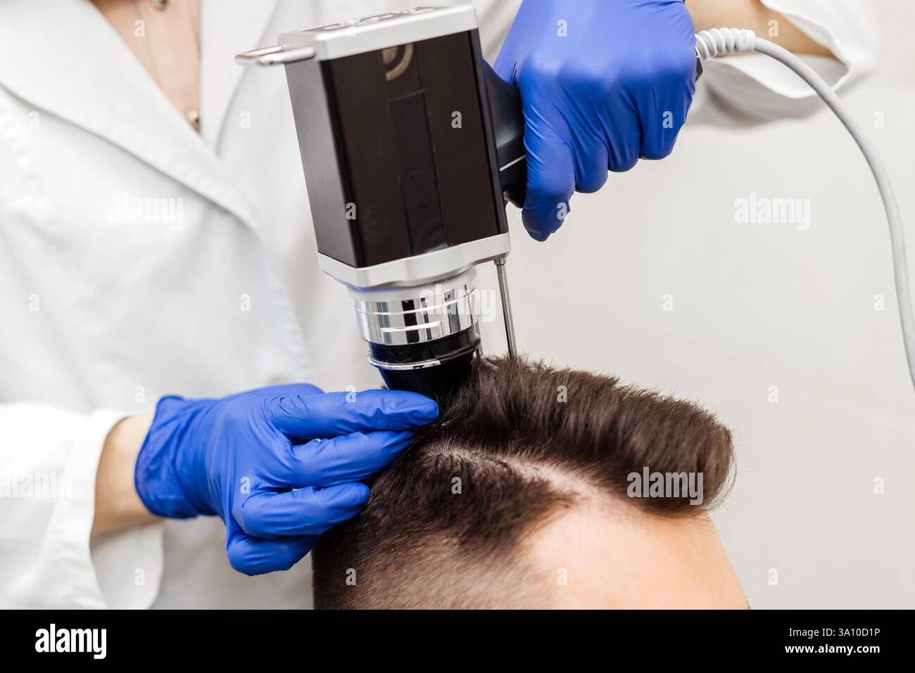 Phototrichogram follicles hi-res stock photography and images - Alamy