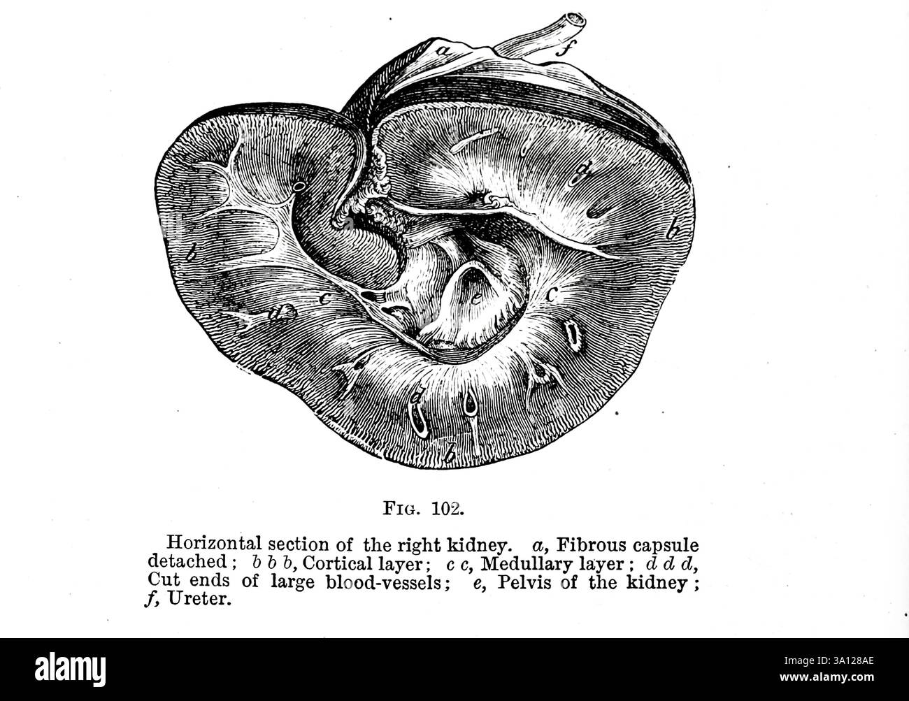 Horizontal section of the right kidney, a. Fibrous capsule detached ...