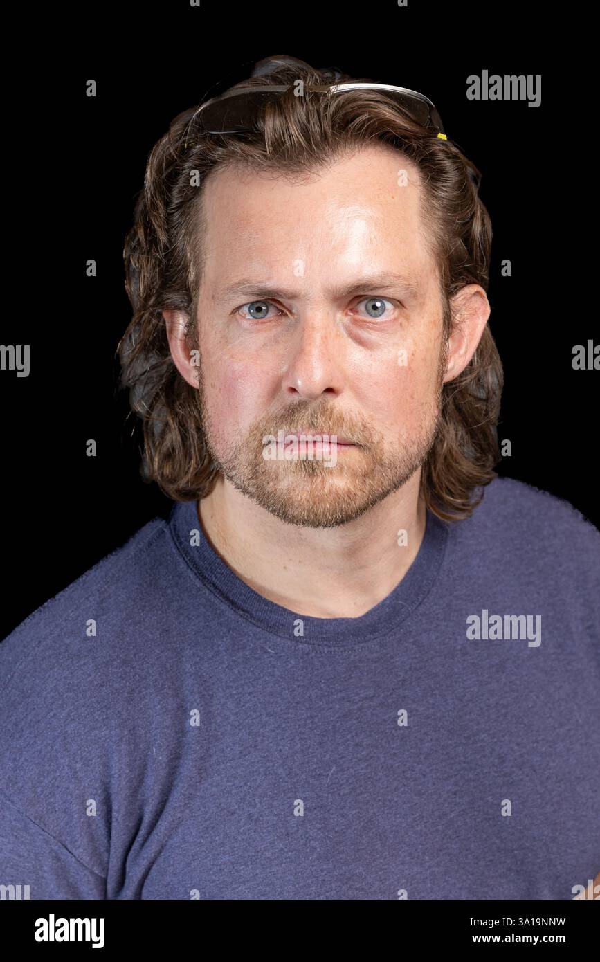 close up portrait of an adult male suffering from Bell's Palsy, a ...